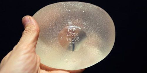 Prothèses PIP : « un challenge médical et chirurgical inédit ...