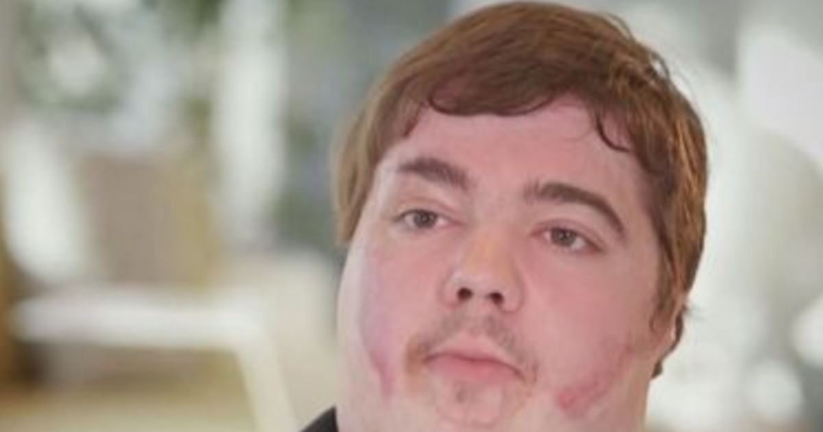 Pourquoi revoir l'émouvant téléfilm sur Jonathan Destin, symbole du ...